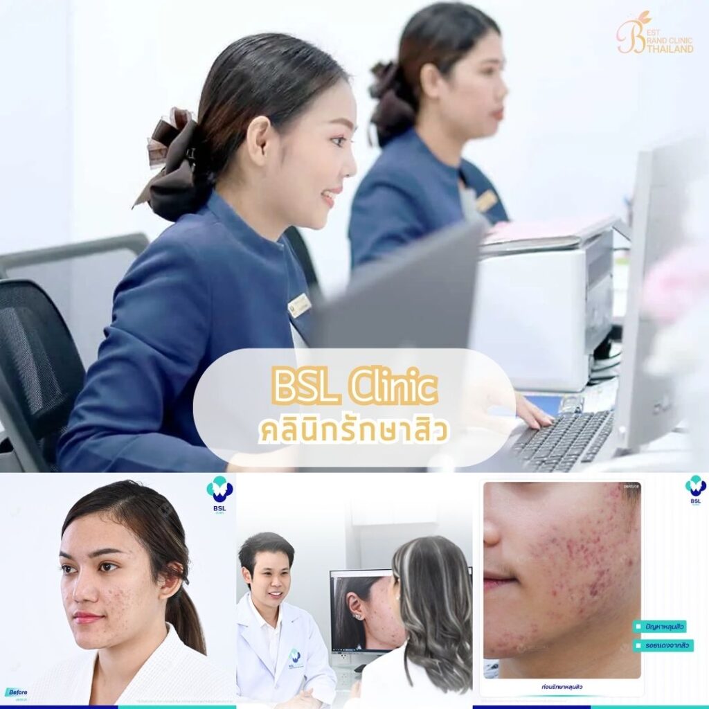 แนะนำ 15 คลินิกรักษาสิว ที่ไหนดี? หมอไม่เลี้ยงไข้ ราคาไม่แพง 2025
