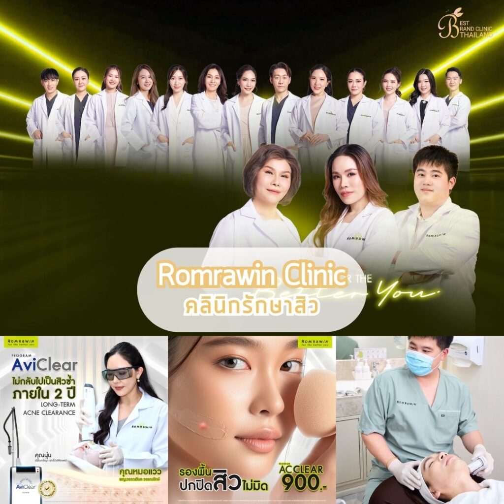 แนะนำ 15 คลินิกรักษาสิว ที่ไหนดี? หมอไม่เลี้ยงไข้ ราคาไม่แพง 2025