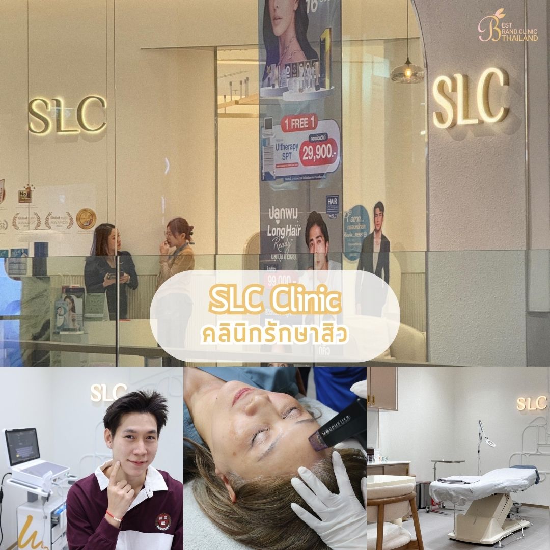 แนะนำ 15 คลินิกรักษาสิว ที่ไหนดี? หมอไม่เลี้ยงไข้ ราคาไม่แพง 2025