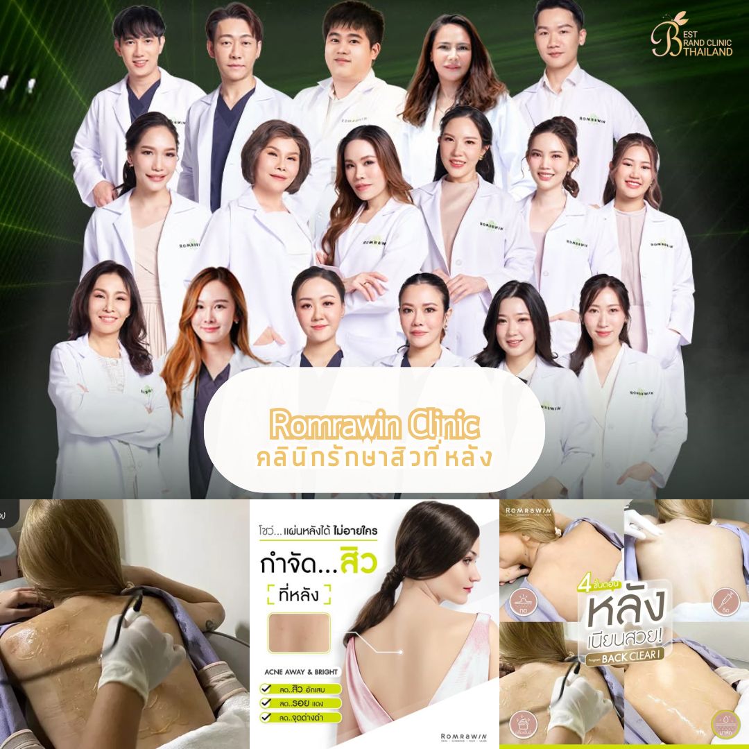 15 คลินิกรักษาสิวที่หลัง ที่ไหนดี? ให้หายขาด ไม่กลับมาเป็นซ้ำ ...